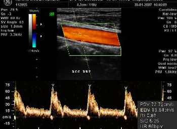 Eco-Doppler - Clínica CMP OVAR - Centro Médico da Praça
